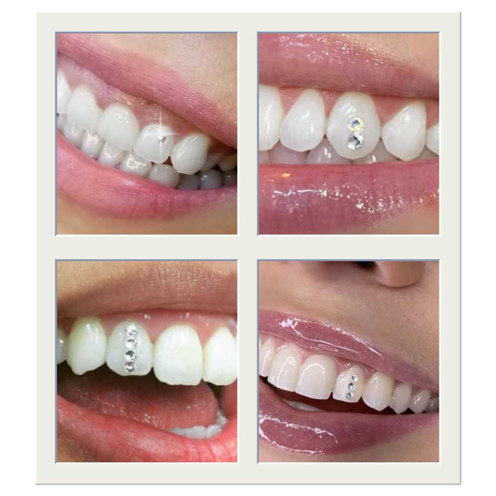 Professional Tooth Gem Kit - Complete Application KIT – Tri-Dente