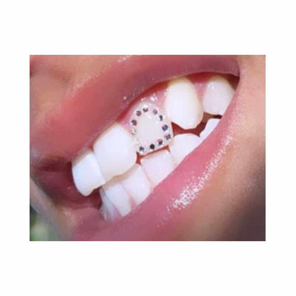 Professional Tooth Gem Kit - Complete Application KIT – Tri-Dente